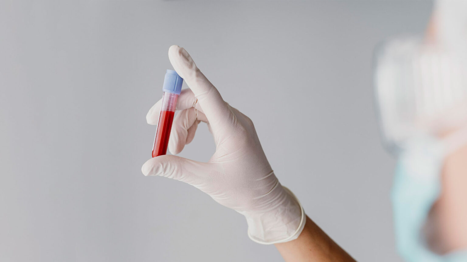 Exames de Sangue Mais Importantes - Guia completo